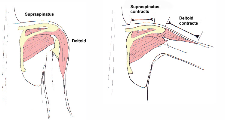 Free Anatomy Quiz - Articles : How do muscles move bones?
